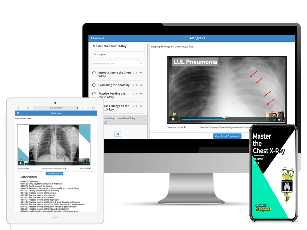 Master the CXR Order Form